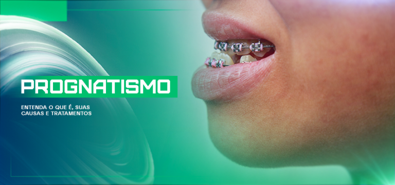 Prognatismo: Entenda o que é, suas causas e tratamentos
