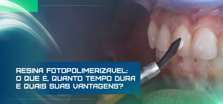 Resina fotopolimerizável: o que é, quanto tempo dura e suas vantagens