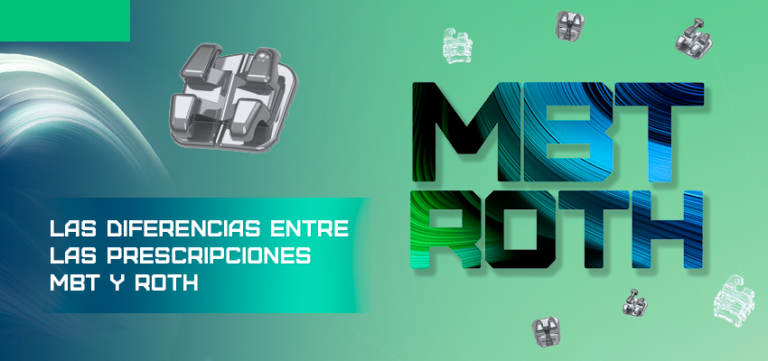 Sistema MBT y Roth ¿cuál elegir?